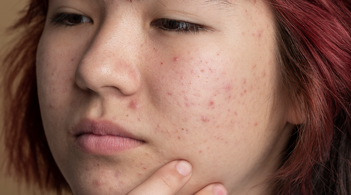 Different Types of Skin Texture – Seek Space
