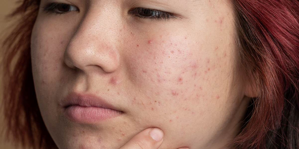 Different Types of Skin Texture — Seek Space